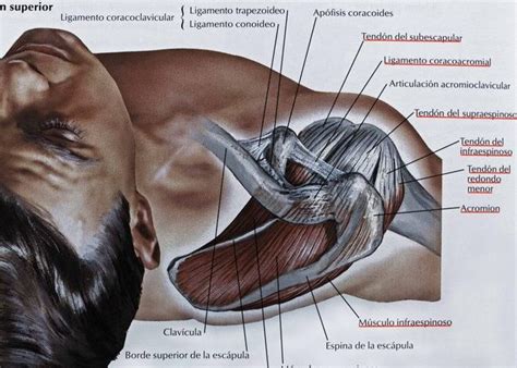 Síndrome subacromial Qué es y cómo tratarlo
