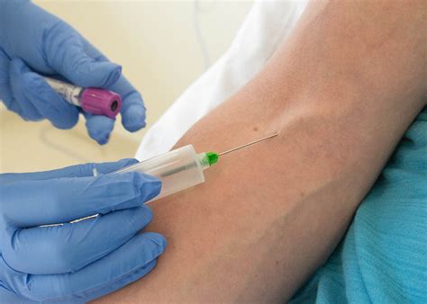Venepuncture Medistudents