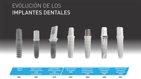 Piezas Que Componen Un Implante Dental Cl Nica Dental Seoane Pamp N