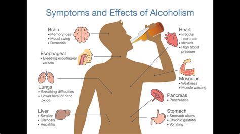 Long Term Effects Of Alcoholism Effects Of Alcohol On The Body
