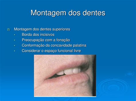 PPT Oclusão em Prótese Dentária PowerPoint Presentation free