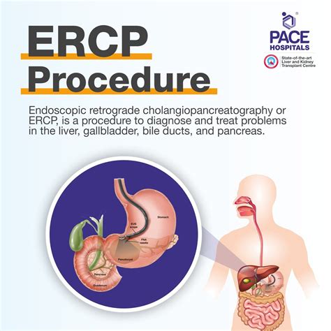 Ercp Courses Maxie Sibelle