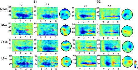 time course and topography of erd and ers during motor imagery download scientific diagram