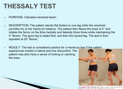 Knee And Ankle Special Tests Flashcards Quizlet