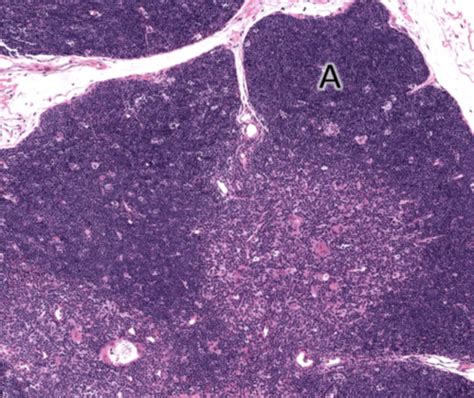 Lymphoid Tissue And Organs Quiz Flashcards Quizlet