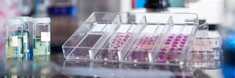 Tumori Del Colon Retto Integrazione Tra Biopsia Liquida E Tissutale