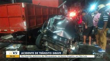 Bom Dia Mirante Acidente grave é registrado na Avenida Jerônimo de