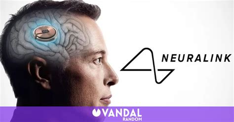 Elon Musk Busca Voluntarios Para Empezar A Probar En Humanos Su Chip
