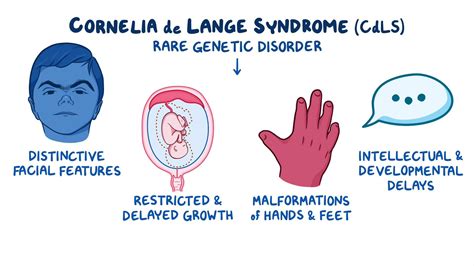 Cornelia De Lange Syndrome Year Of The Zebra Video Osmosis