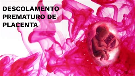 DDP Descolamento Prematuro de Placenta by Desirée Tomitão on Prezi Next
