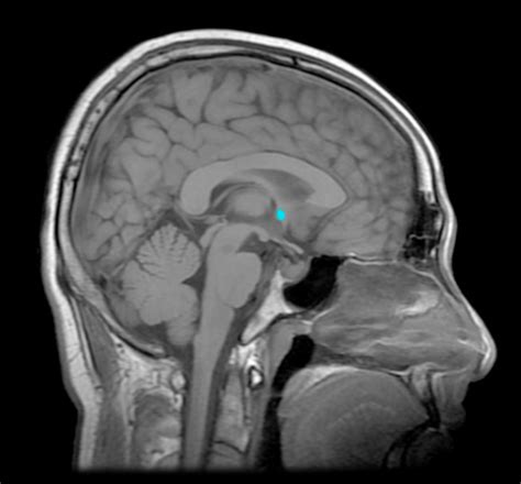 Imaging Flashcards Quizlet