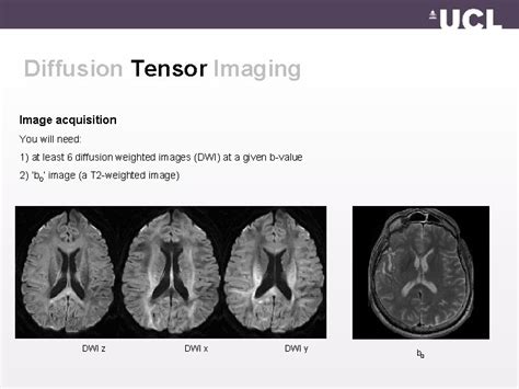 Diffusion Tensor Imaging Overview Theory Basic Physics Tensor