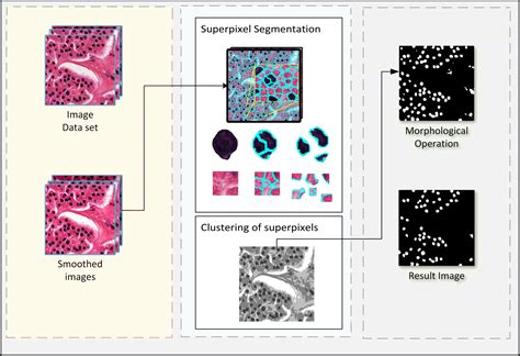 automatic cell segmentation in histopathological images via two staged superpixel based