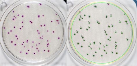 how to count bacterial colonies on agar plate