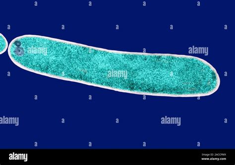E Coli Bacterium Coloured Transmission Electron Micrograph TEM E