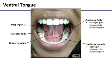 Anatomy Of Underside Of Tongue