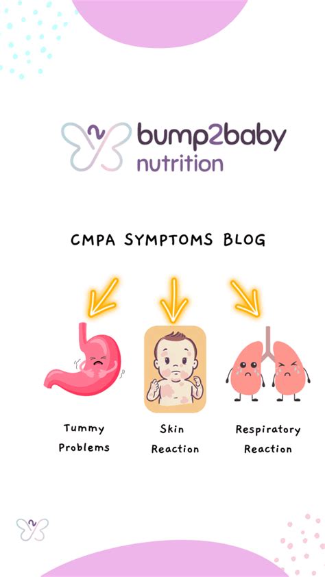 CMPA Symptoms How To Spot The Signs Of Milk Allergy