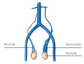 Intra Procedures And Treatments Interventional Radiology