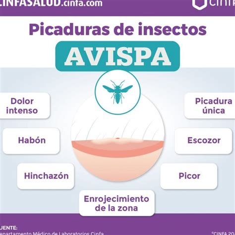 Picadura de abeja síntomas tratamiento y consejos para aliviar el dolor