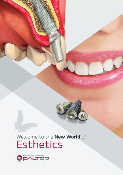 Paltop Dental Implants SpotImplant