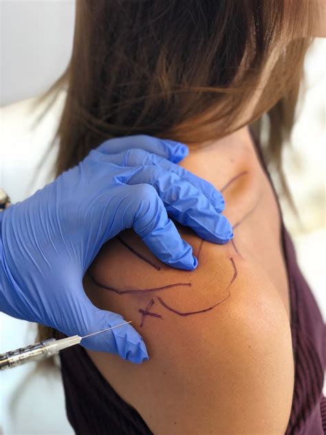 Stem Cell Injections For Shoulder Arthritis NeoGenix Stem Cells