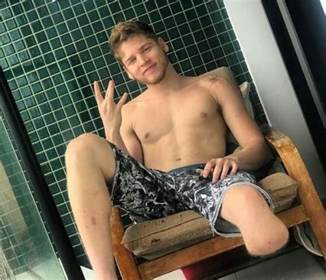 Male Amputees Hot Feet On Tumblr