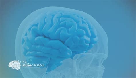 O Que Devemos Saber Sobre O Edema Cerebral Dr Victor Barboza