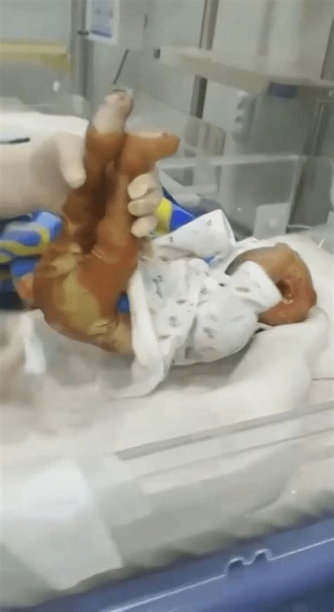 Un B B Issu Dun Inceste Meurt Quelques Heures Apr S Sa Naissance