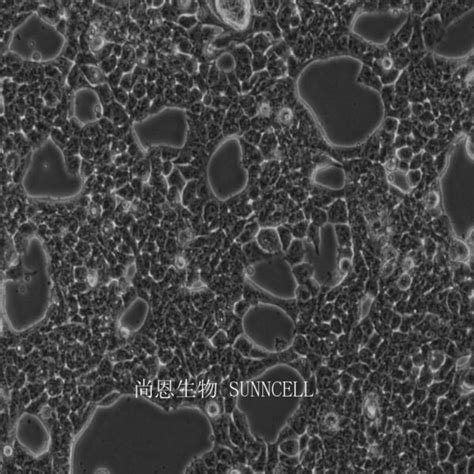293T 17细胞 人胚肾细胞 武汉尚恩生物技术有限公司