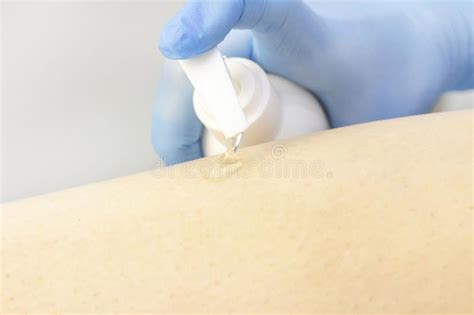 Tratamiento De La Piel De Las Piernas Antes Y DespuÃs Del