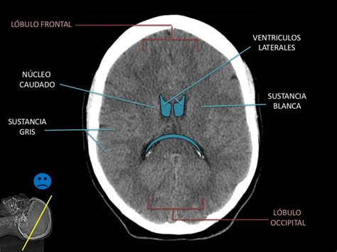 NEUROTAC ANATOMIA BASICA DR MENDOZA Y JOB