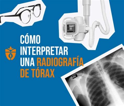 Cómo Interpretar una Radiografia de Torax Normal CFI