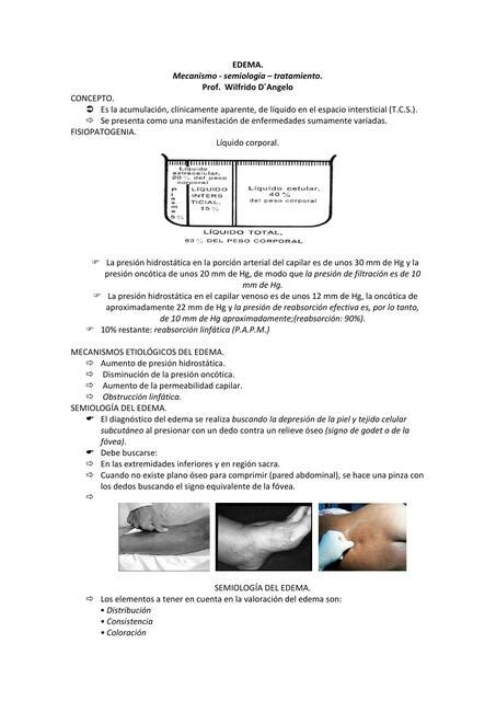Edema Mecanismo Semiolog A Tratamiento Estudiante Medicina Udocz