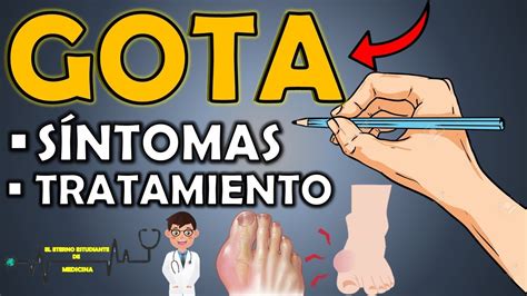Qu Es La Gota Todo Lo Que Debes Conocer S Ntomas Causas