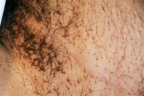 Dermatoweb Net