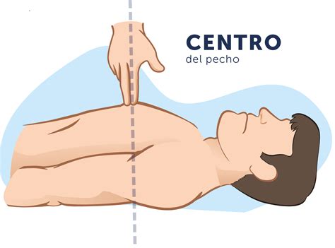 RCP por qué es importante aprender a practicarla OSDE