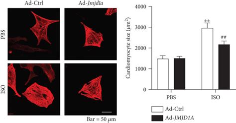 JMJD1A Overexpression Represses Cardiomyocyte Hypertrophy A