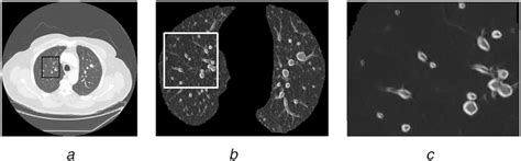 edge detection a we perform multi‐scale edge detection method on an download scientific