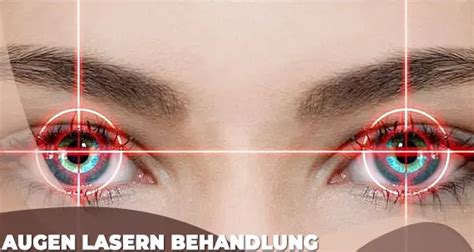 Augen Lasern Behandlung Kosten In Istanbul T Rkei Dixi