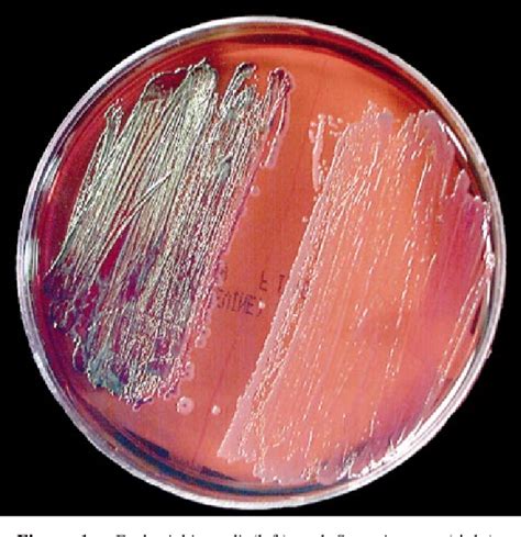 Pseudomonas Aeruginosa Emb Agar