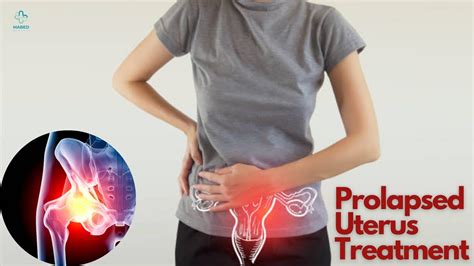 Prolapsed Uterus Treatment At Home Effective Solutions For Comfort And