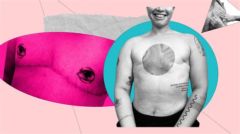 Gender Affirming Tattooing Can Bring Post Op Euphoria Xtra Magazine