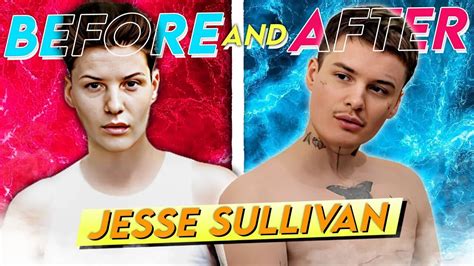 Jesse Sullivan Before After His Full Transformation