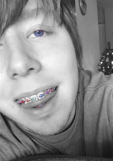 Braces Tumblr Girls Giving Head