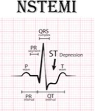 Acute Coronary Syndromes ACS Flashcards Quizlet