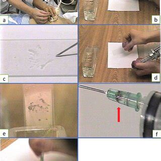 Standard Correct Method Of Fine Needle Aspiration Cytology Excerpt