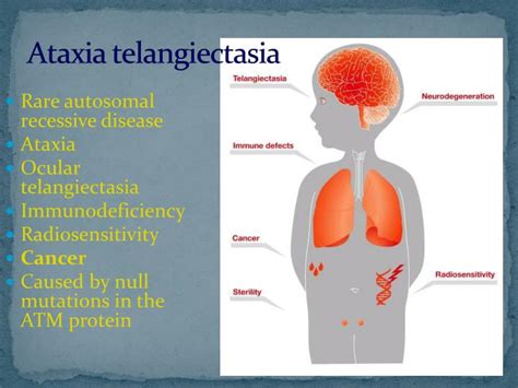PPT Ataxia Telangiectasia And The Role Of ATM PowerPoint Presentation