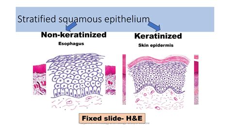 Stratified Squamous Epithelium Keratinized Vs Non Keratinized