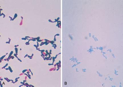 Chapter Aerobic Gram Positive Bacilli Corynebacterium Spp