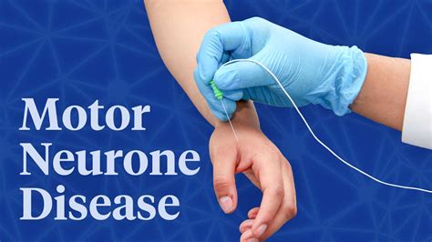 Nursing Care Of Motor Neurone Disease MND Ausmed